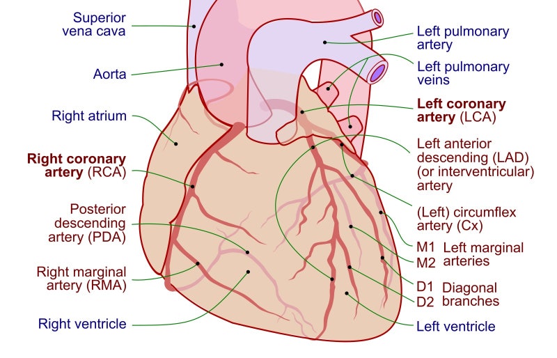 LAD, LCX, RCA 구분하는 법 ; coronary angiograpy 보는 법 : 네이버 블로그