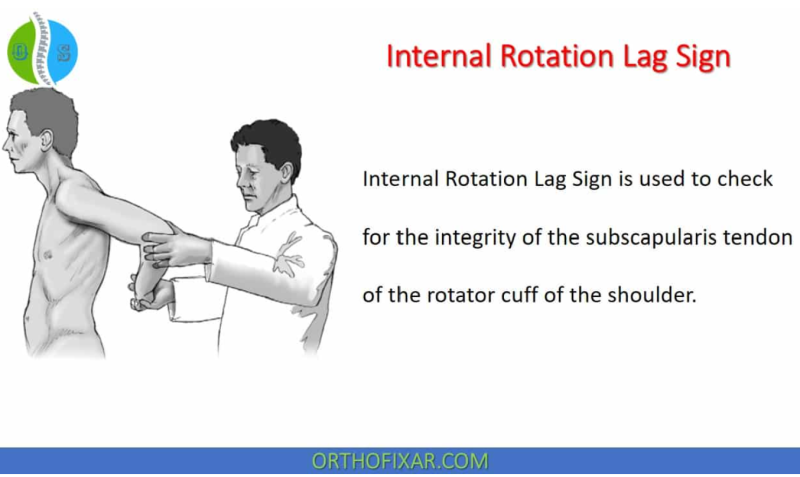 어깨의 문제로만 봐야하는가? 어깨 통증 평가 (회전근개파열, 충돌증후군(rotator cuff syndrome ...