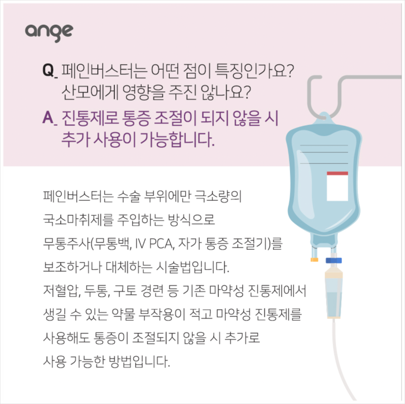 임신37주차 제왕절개 페인버스터 알아보기 네이버 블로그