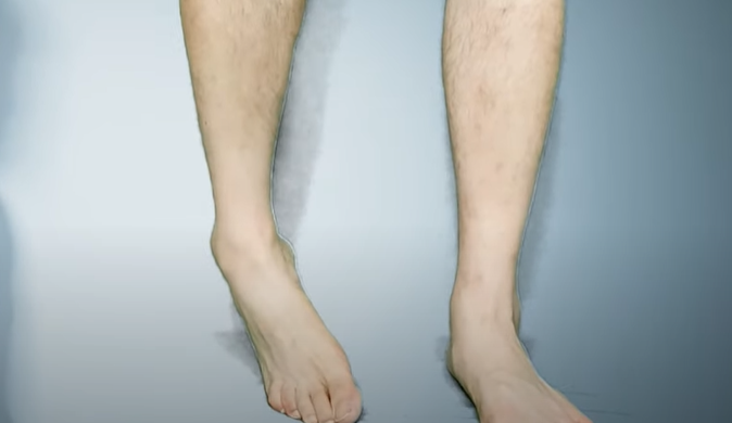 발목 인대 늘어났을때 증상 반드시 확인해야할 3가지 Ft 접질렀을때 삐었을때 네이버 블로그