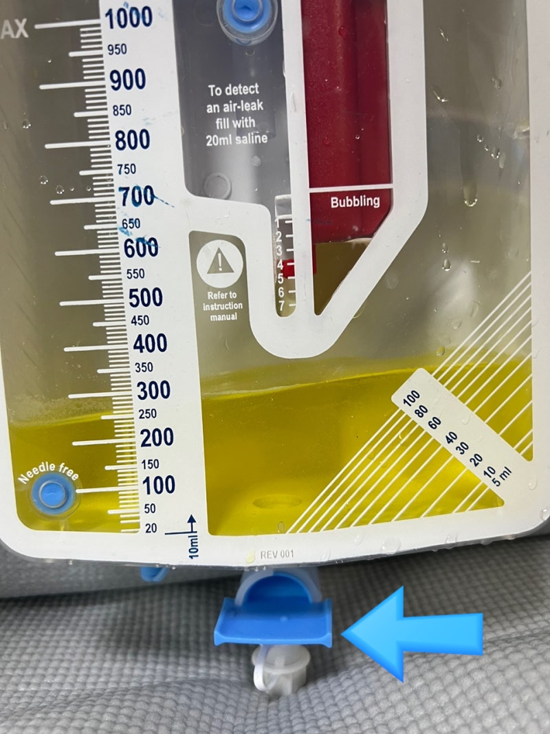 SINAPI Chest Bottle(시나피 체스트 보틀)에 대한 모든것(설명, 적응증, 설치, 장점, 임상적용) : 네이버 블로그