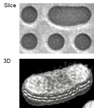 [AXI] BGA 자동검사 요청 : 네이버 블로그
