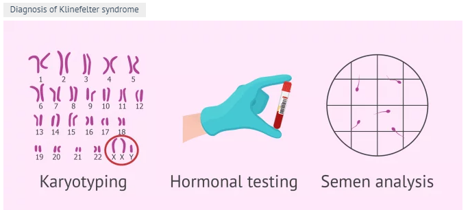 클라인펠터 증후군의 진단,증상,합병증,치료가 궁금해요. : 네이버 블로그