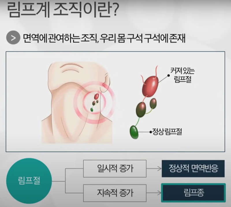 림프종 공부 1편 림프종의 원인 증상 아형 사례 네이버 블로그