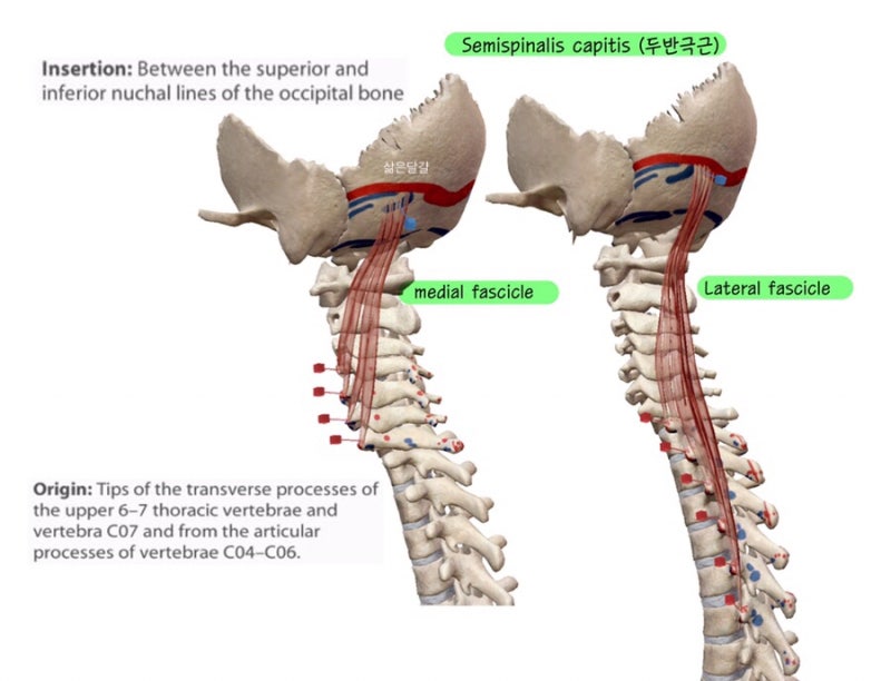 [MPS]두반극근,경반극근,다열근(Semispinalis capitis/cervicis, Multifidi)/후경부근육(기시 ...