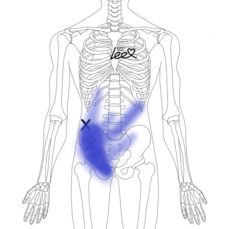 외복사근(배바깥빗근, External Oblique) 통증유발점(Trigger point) : 네이버 블로그