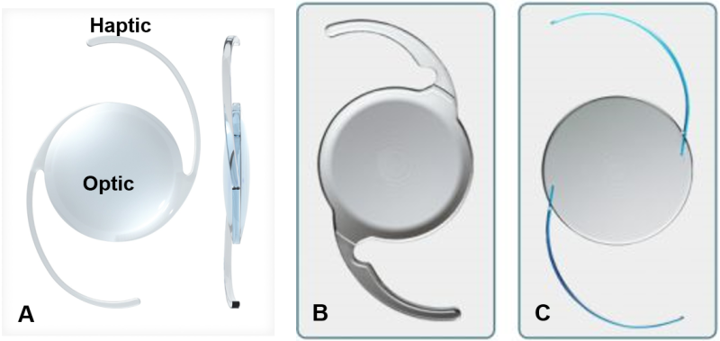 [EYE잘보여] 인공수정체는 어떤 것들이 있을까? - 인공수정체(IntraOcular Lens; IOL)의 종류 및 재질 ...