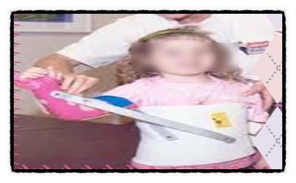 위팔 신경 얼기 손상 brachial plexus injury, BPI : 네이버 블로그