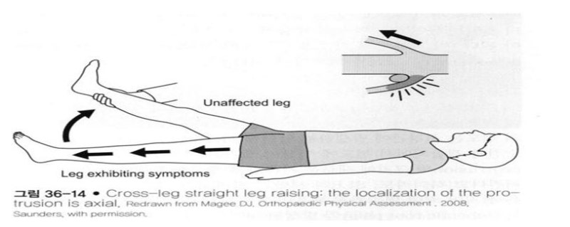 SLR[Straight Leg Raise,하지직거상] 잘 활용하고 있나요 ? : 네이버 블로그