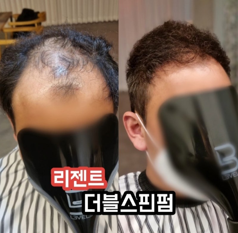 서울탈모미용실 미사탈모 머리숱 없는 남자 펌 탈모크롭컷 탈모커버펌 남자탈모펌미용실 정수리탈모파마 남자탈모커버파마 네이버 블로그