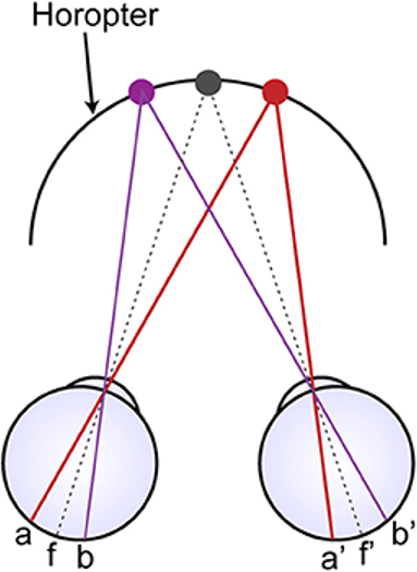 [EYE잘보여] 사시와 사위는 어떻게 다를까? - 사시 용어와 표기법 : 네이버 블로그