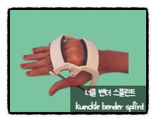 위팔 신경 얼기 손상 brachial plexus injury, BPI : 네이버 블로그