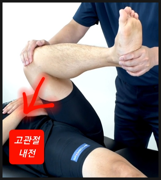 고관절 통증 원인 검사 - 고관절충돌증후군(Hip impingement syndrome) : FADIR test : 네이버 블로그