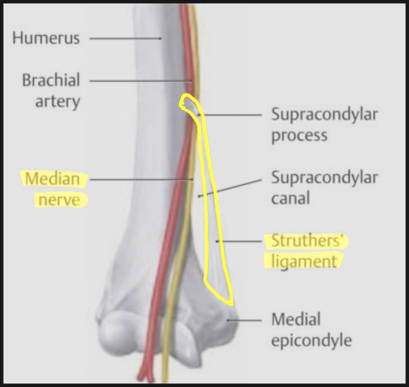 정중신경(Median nerve) : 기시, 기원, 경로, 분류, 지배근육, 손상, 정중신경병증 : 네이버 블로그