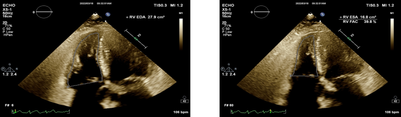 RV function : 네이버 블로그