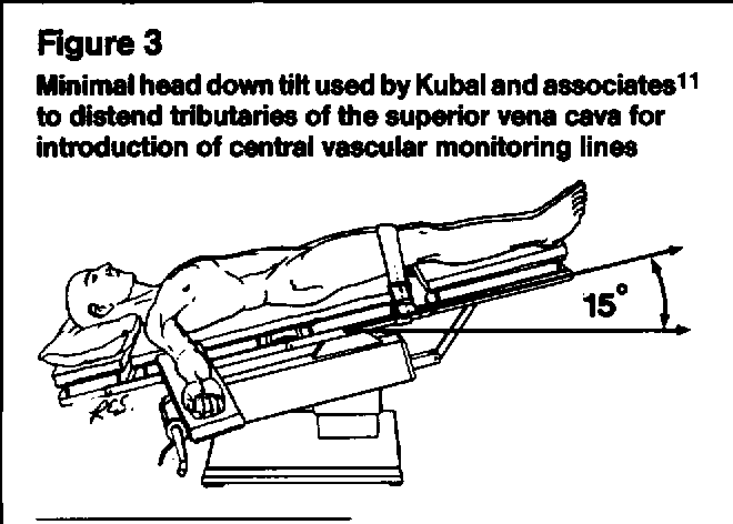체위 의학용어 Fowler position, prone position, supine position 등등 : 네이버 블로그