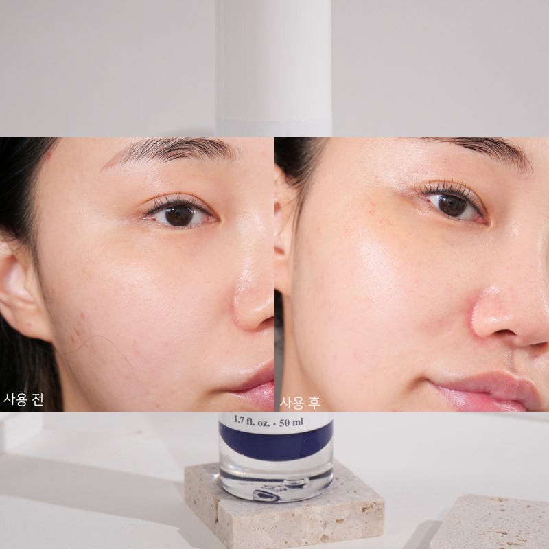 키엘 신제품 스킨 리뉴잉 마이크로 도즈 세럼 가을 안티에이징으로 딱이야 4주 후기 네이버 블로그