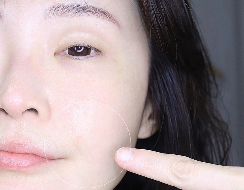 입가주름 피부탄력은 주름개선화장품 뮤신콜라겐 달팽이크림 안티에이징 후기 ♥ 네이버 블로그