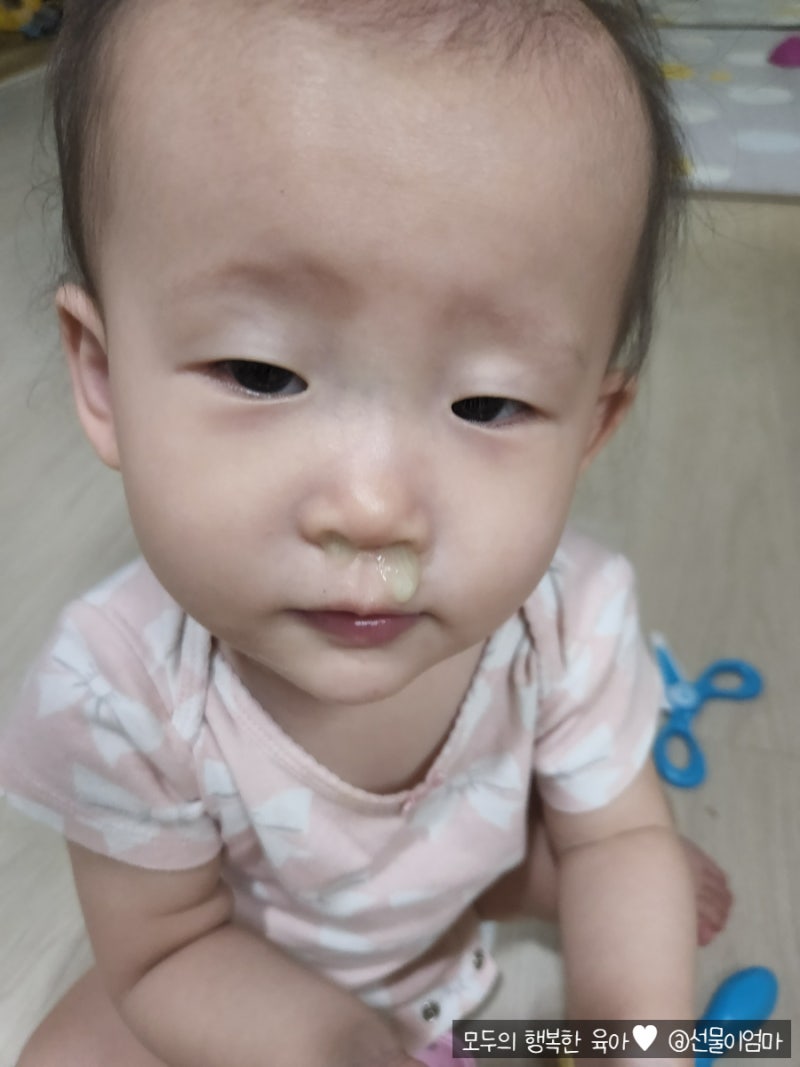 아기 중이염 증상과 치료법은 Ft 아기 코감기 심해져서 중이염까지 네이버 블로그