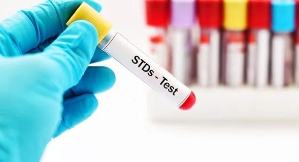 성병검사 가격 Std 여자 남자 매독 성병 증상 피부발진 매독 검사 여성 성병 증상 네이버 블로그