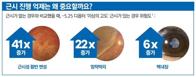 호야 마이오스마트 아트로핀 마이사이트 드림렌즈 그 무엇보다 안전한 근시완화안경 마이오스마트로 성장기 어린아이의 근시를