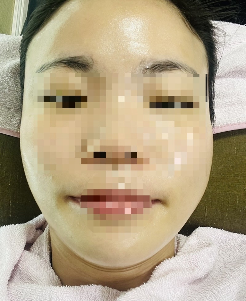 만족 100 포항문덕피부관리 슈팅탄력테라피 네이버 블로그