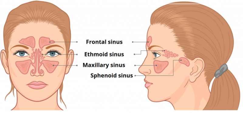 (수술 공부) ENT: Endoscopy sninus surgery, ess:sinusitis,비부비동염수술,축농증 : 네이버 블로그