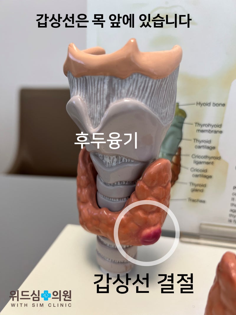 건강검진 갑상선 초음파검사로 알게 된 혹 결절 병원에서 정밀검사를 받는 것이 도움 되는 경우와 재검사가 언제 필요한지