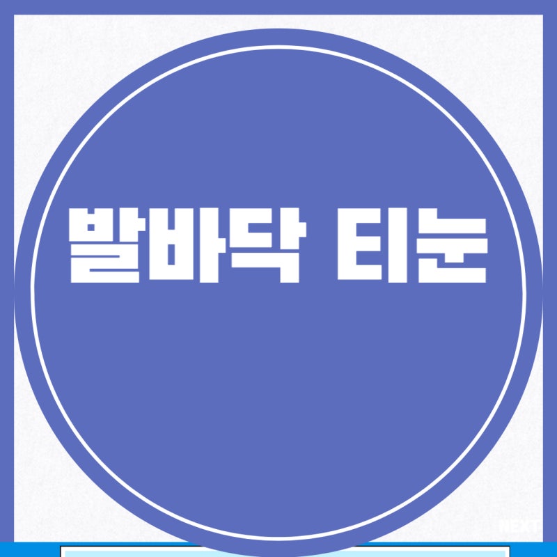 발바닥 티눈 원인 굳은살 사마귀 티눈 차이점 제거 티눈밴드 바르는 티눈약 티눈액 네이버 블로그