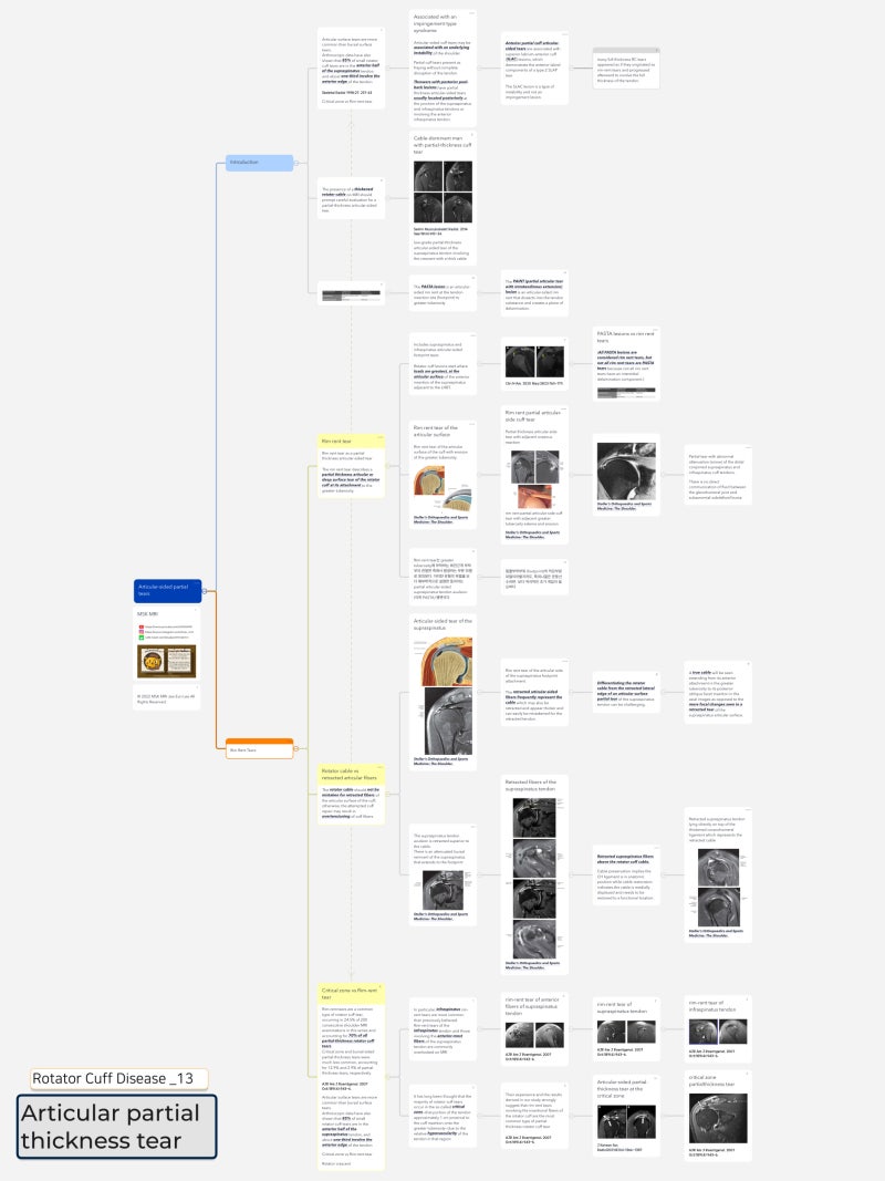 [Rotator cuff Tear 13] #1 Articular Rotator Cuff Partial Tear, PASTA ...