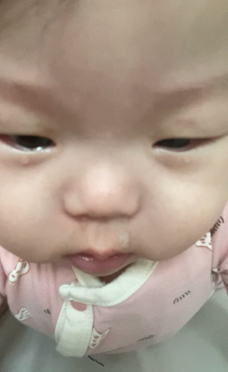 6개월 아기 코감기 목감기 빨리 낫는 방법 네이버 블로그
