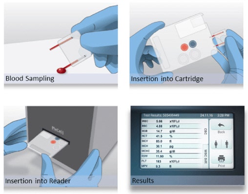 PixCell HemoScreen™ 현장검사용 혈구분석기 : 네이버 블로그