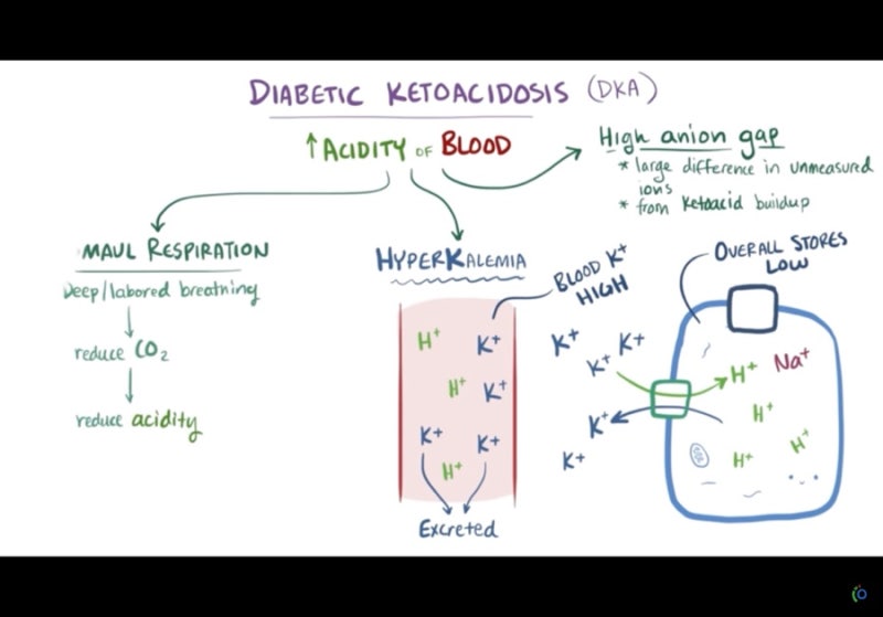 당뇨병성 케톤산증 (Diabetic Ketoacidosis) 의학용어 DKA 공부하기 : 네이버 블로그