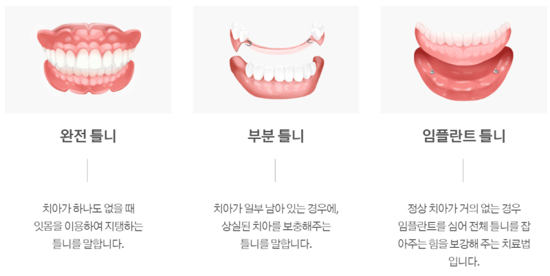 틀니 가격 비용 총정리완전 부분 임플란트 네이버 블로그