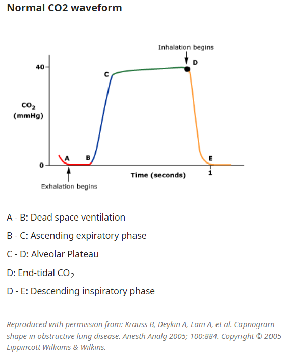 End-Tidal Carbon Dioxide (ETCO2, 호기말 이산화탄소) 적용 및 활용. : 네이버 블로그