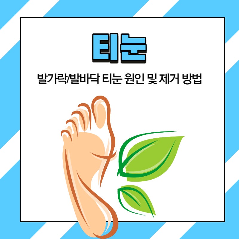 발가락발바닥 티눈 원인 및 제거 티눈 사마귀 차이 및 티눈약 정보 네이버 블로그