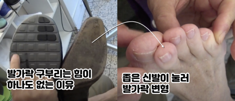 65. 아킬레스 통증 KSNS 스본 스도 15분 해결 : 네이버 블로그