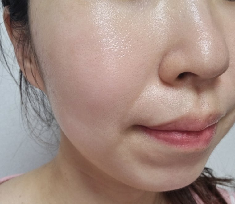 Aife 에이프 올라겐 탄력앰플 홈케어 : 네이버 블로그