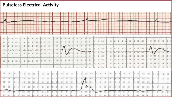 ★ACLS(CPR기초 지식) : 네이버 블로그