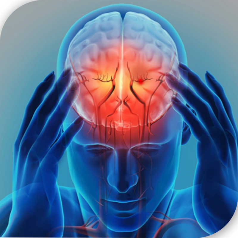 의학용어 CVA, SDH, EDH, SAH, ICH, IVH 뇌혈관계 질환 종류 : 네이버 블로그