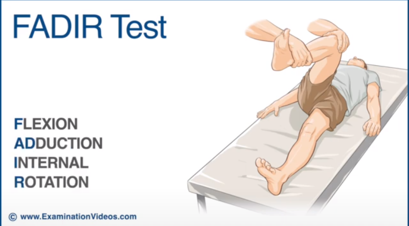 고관절 찝힘(충돌증후군)검사 FADIR test : 네이버 블로그