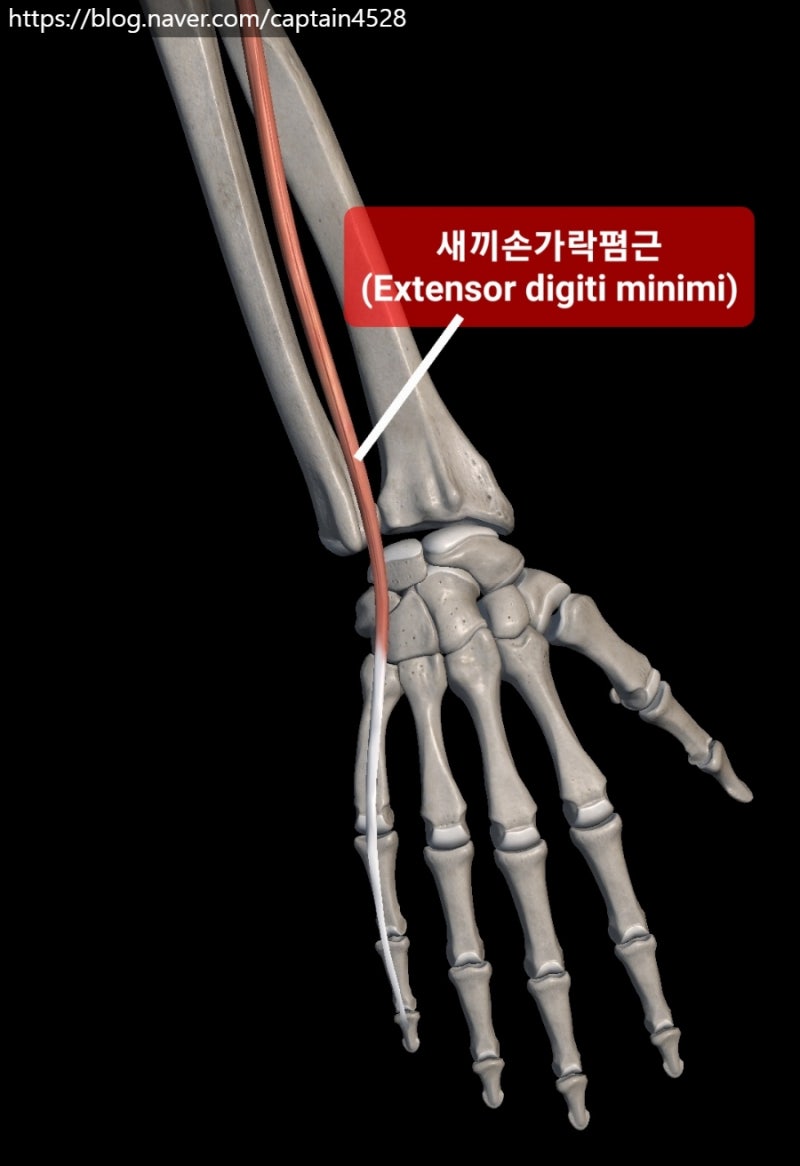 와텐버그 징후(Wartenberg's sign) : Ulnar nerve paralysis - Special test : 네이버 블로그