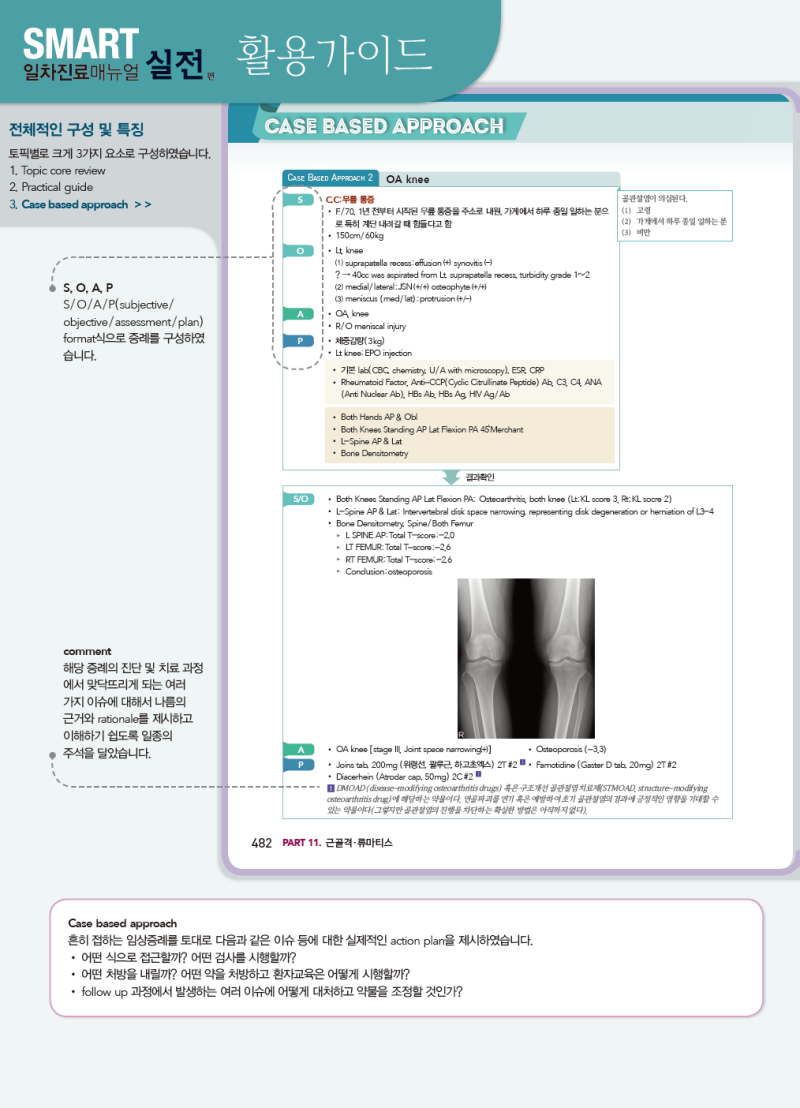 [실전] 과민대장증후군 치료 -약물, Trimebutine, Tiropramide, Lactobacillus, Etizolam ...