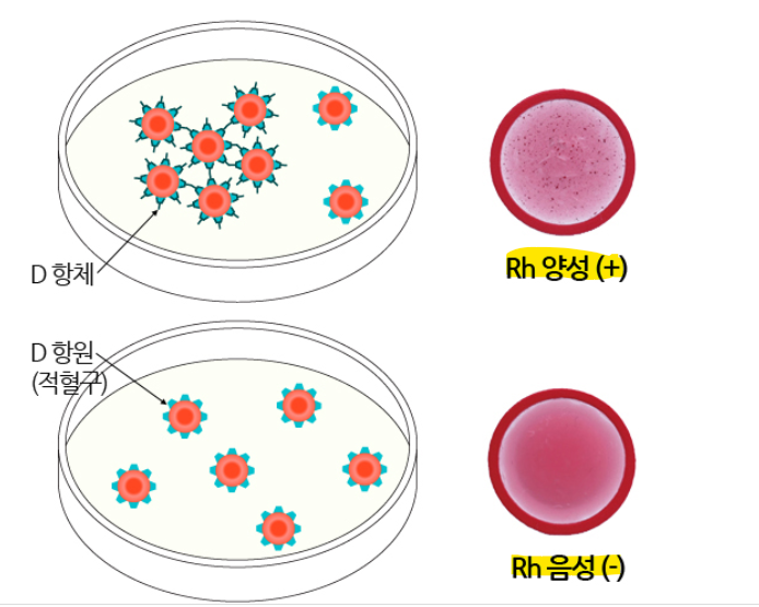 Rh 혈액형이란?/Rh+, Rh- 차이/ Rh 부적합 임신, 적아세포증,태아용혈성질환 : 네이버 블로그
