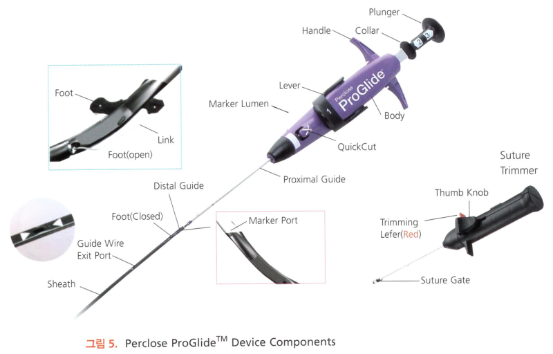 혈관폐쇄기구의 사용방법 3th- Perclose ProGlide : 네이버 블로그