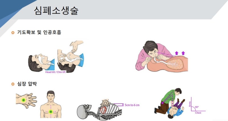 심폐소생술 성인소아영아 Cpr 방법 및 제세동기 사용법 네이버 블로그