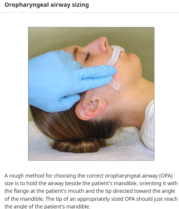 Oropharyngeal airway(구인두 기도기 OPA), Nasopharyngeal airway(비인두 기도기 NPA ...