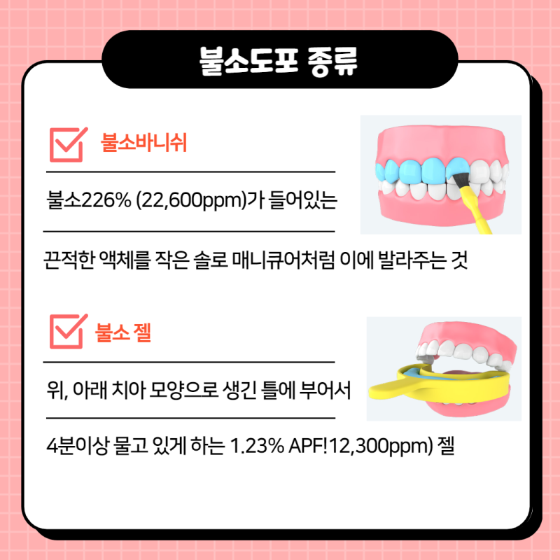 불소바니쉬 소아 불소도포 궁금증 모두 정리 언제부터 얼마마다 효과 주의 사항 네이버 블로그