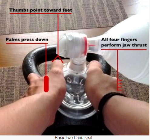 Bag-Valve-Mask(BVM) ventilation (백 밸브 마스크 환기) : 네이버 블로그