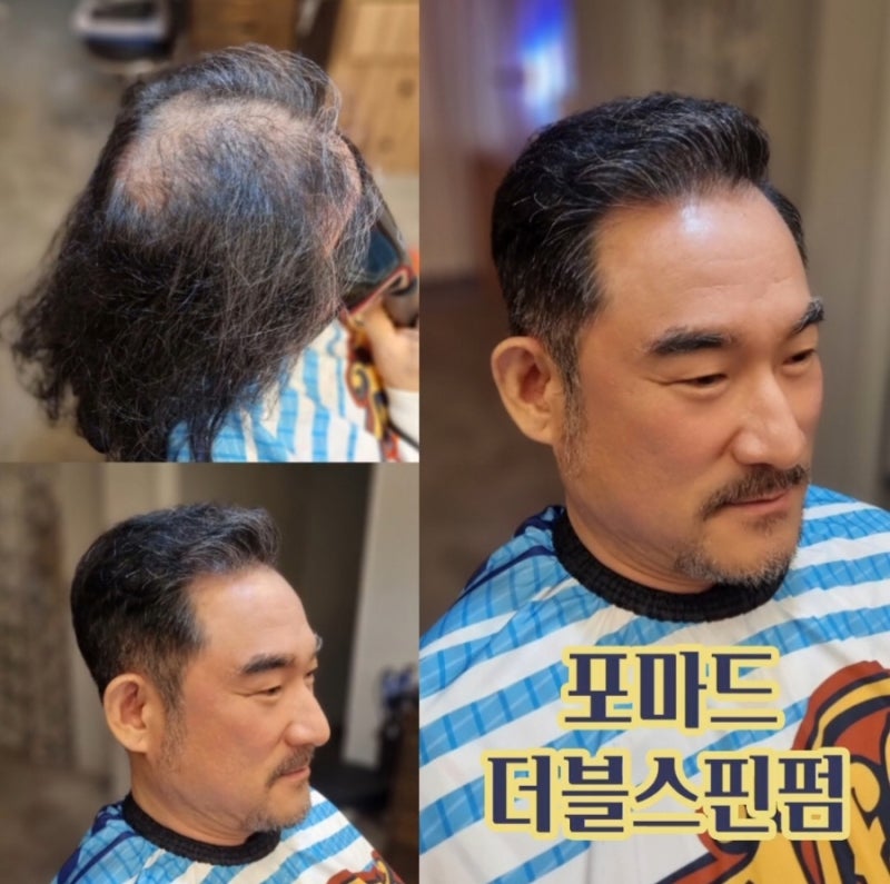 인천 주안동 중년남자머리 간석동 탈모펌 장발머리탈모 탈모장발 정수리탈모커버펌 송도 포마드 정수리탈모펌 M자헤어스타일 남자파마탈모